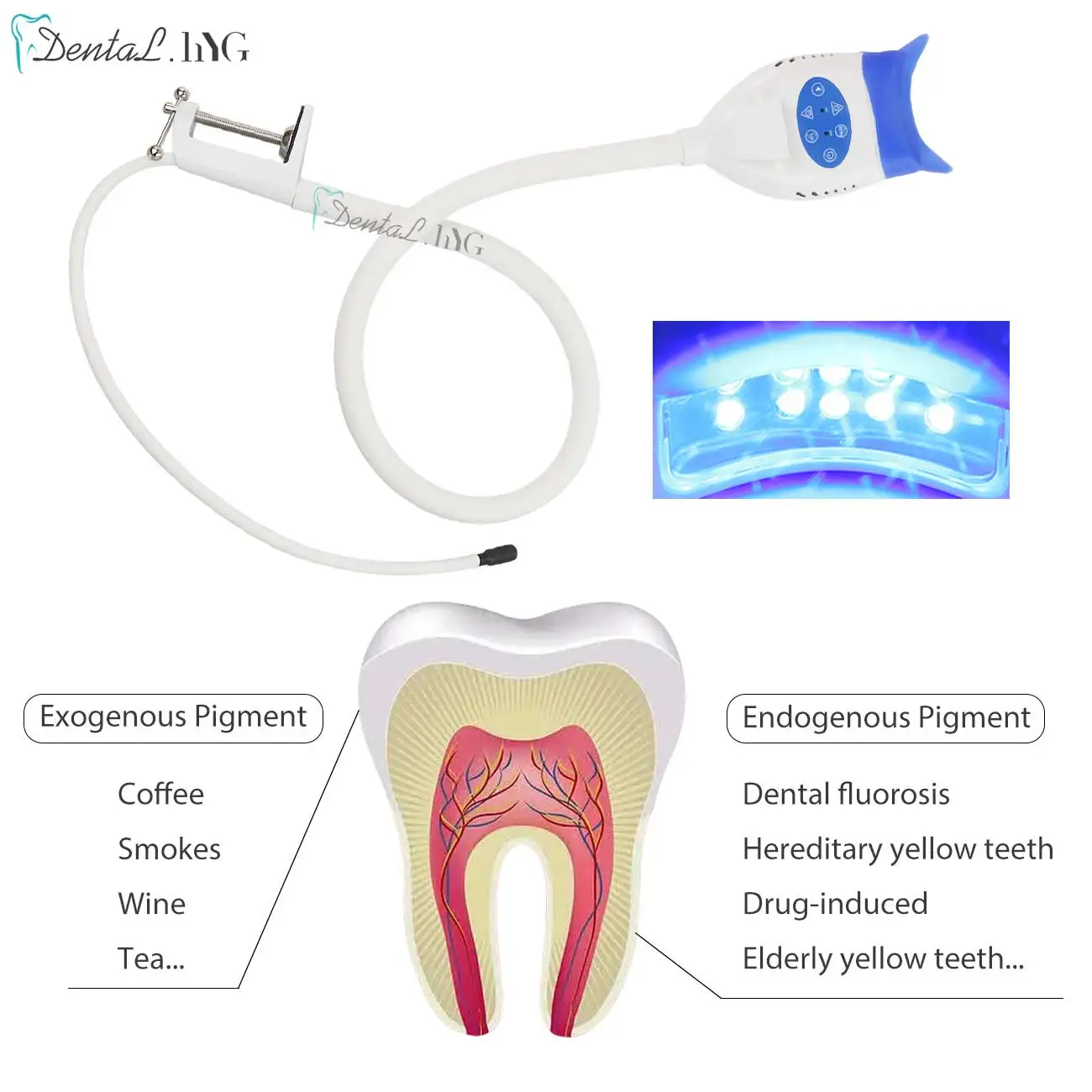 Endogenous Staining Of Teeth