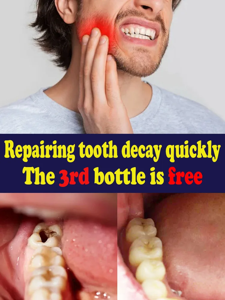 Tooth-Decay-Repair-all-Cavities.jpg