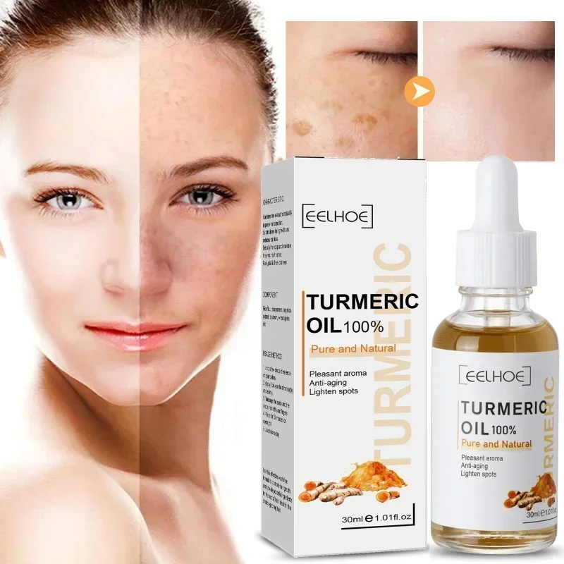 Turmeric-Freckle-Whitening-Serum-Curcumin-Oil-Face-Brighten ...