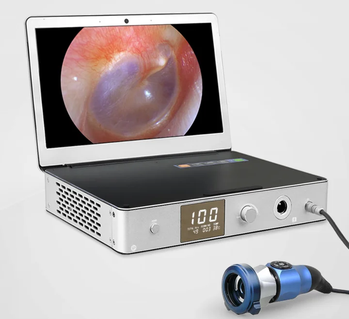 YD-1000S Medical Integrated Portable HD Endoscope Camera System and led ...
