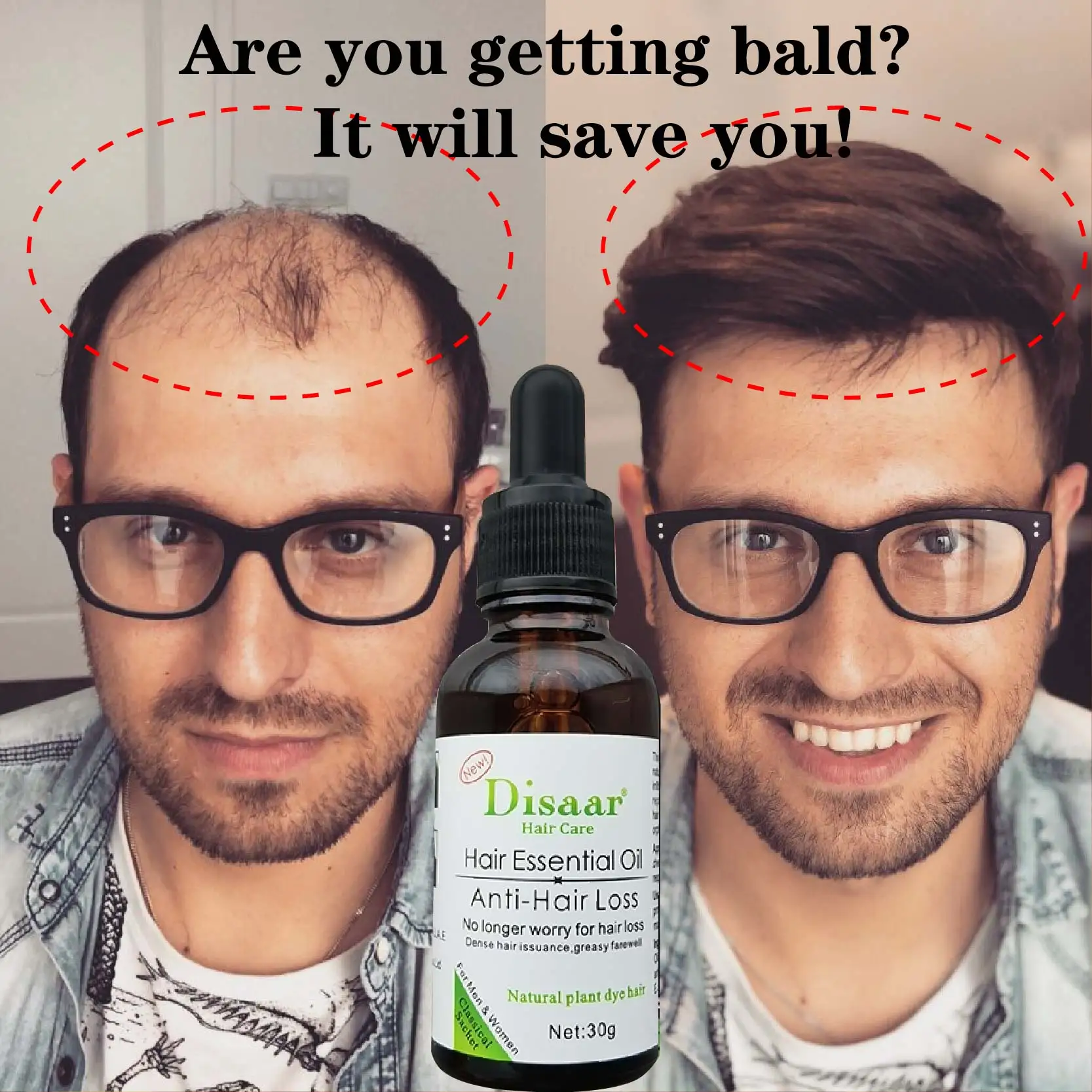 Hair Follicle Repair Hair Growth Plant Essence Oil Rapid Anti-hair Loss ...