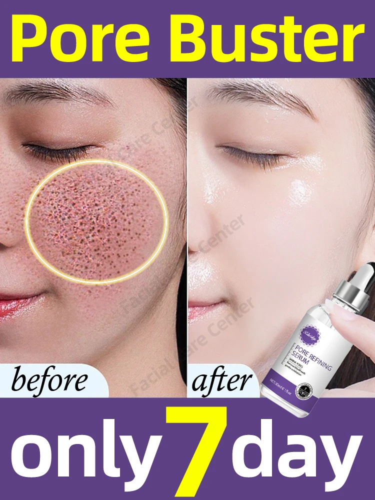 Pore-Shrinking-Serum-Shrink-Pores-Cream-Lactobionic-Acid-Shrink-Pores ...