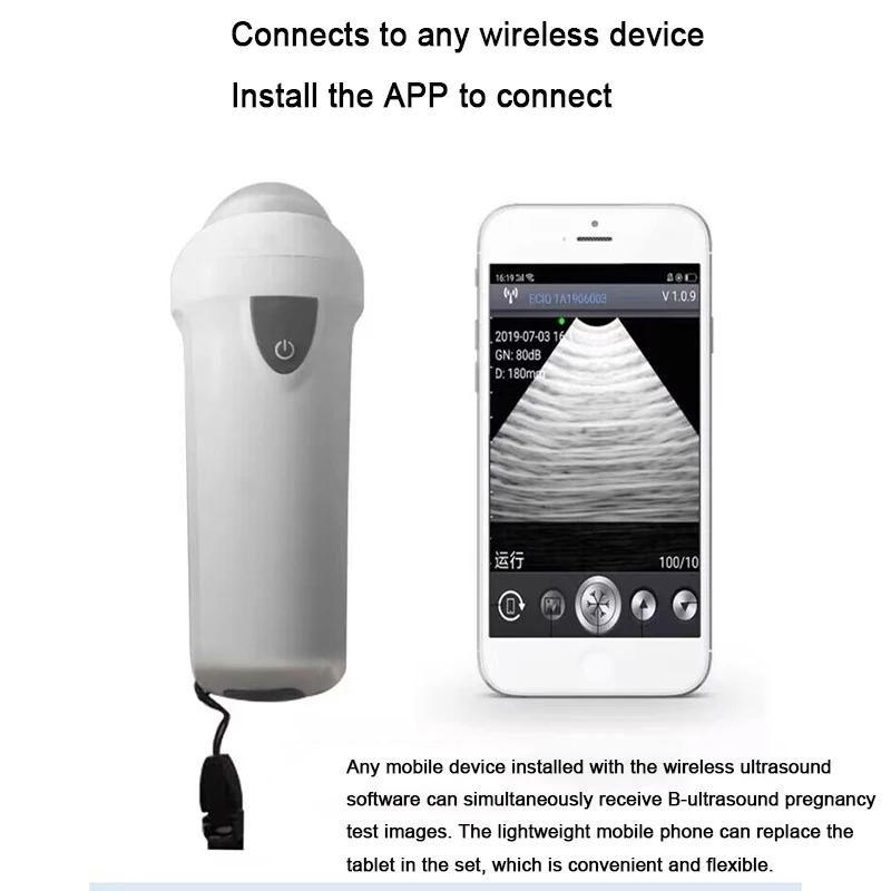 Pig-Sheep-livestock-Wireless-Mechanical-Veterinary-Ultrasound-Scanner ...