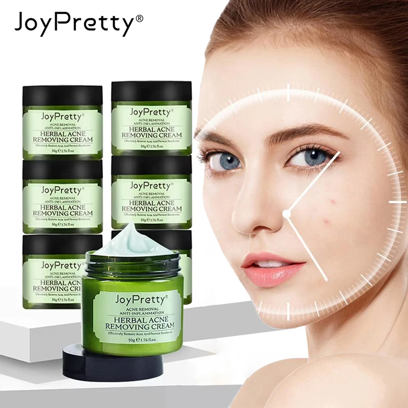 Blackhead Remover Face Cream Enlarged Pores Removal Oil Control Pore ...