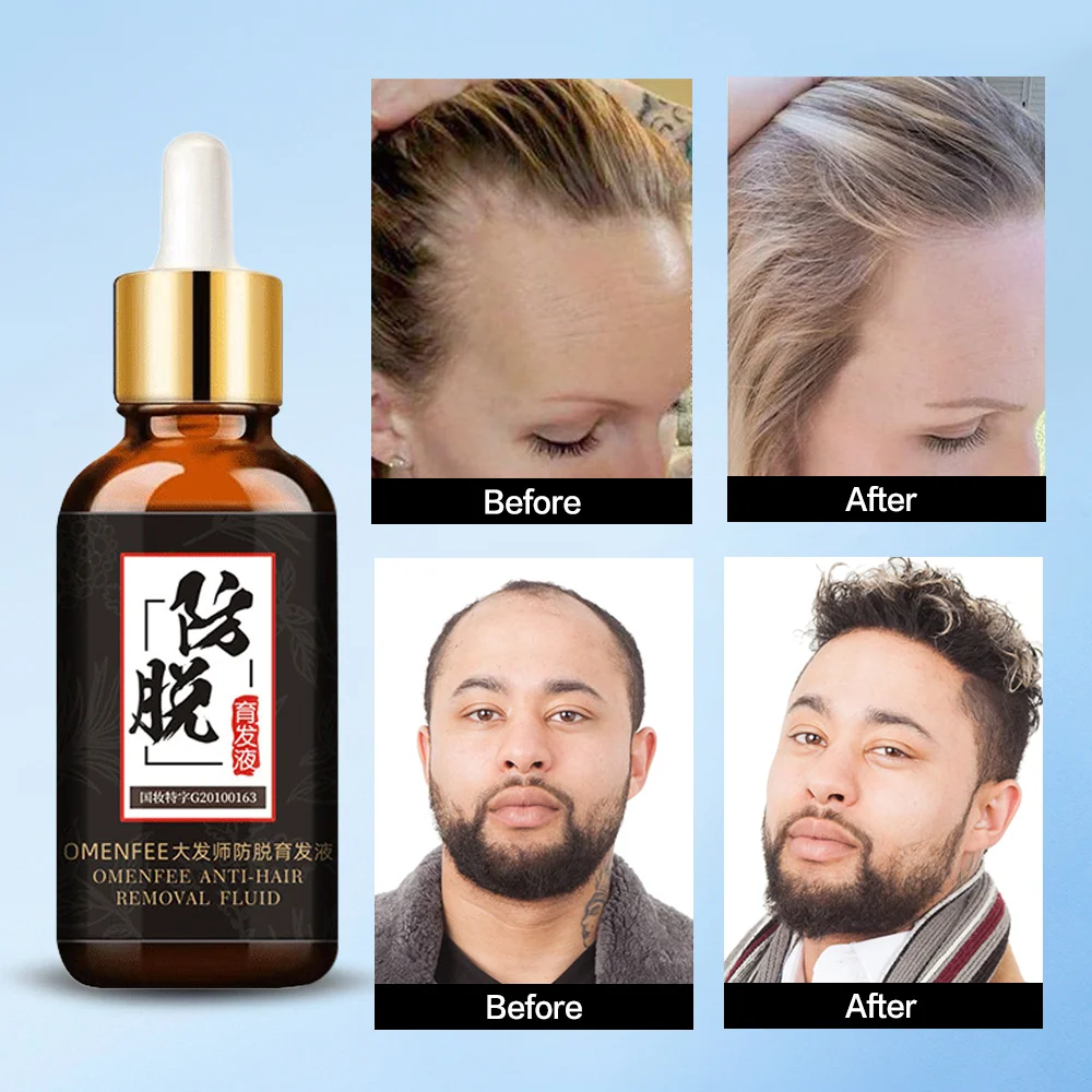 HAIRCUBE Hair Growth Essence Spray Essential Oil Liquid for Men Women Hair Regeneration Repair ...