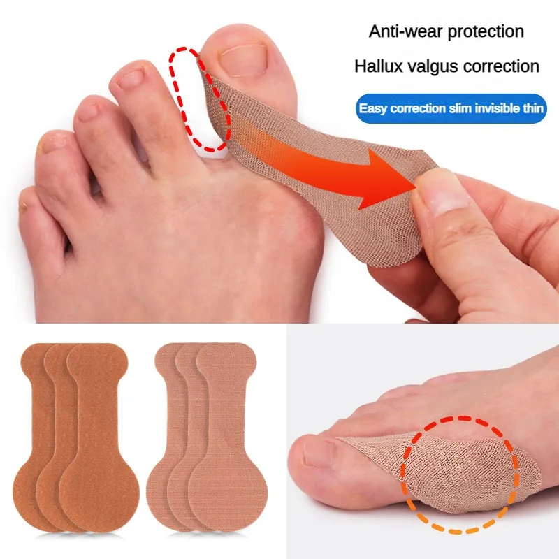 10PCS-Hallux-Valgus-Orthodontic-Patch-Foot-Corrector-Stickers-Hallux ...