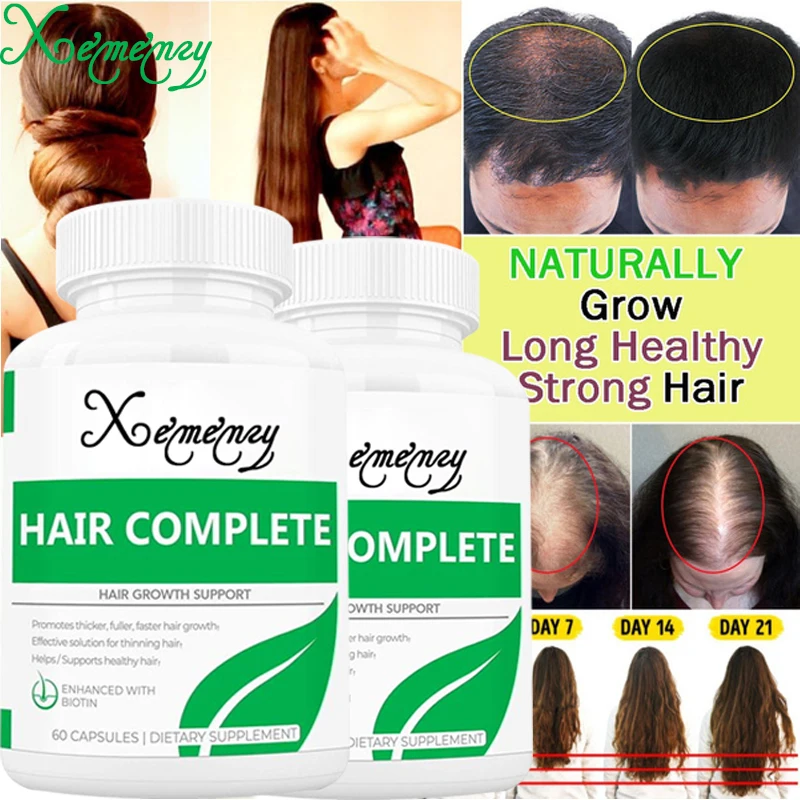 Original-Authentic-100-Hair-Growth-Supplements-Hair-Care-Capsules ...