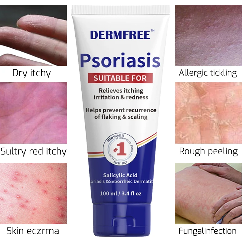 Psoriasis Pied : Symptômes, Causes Et Traitement – DOAMY