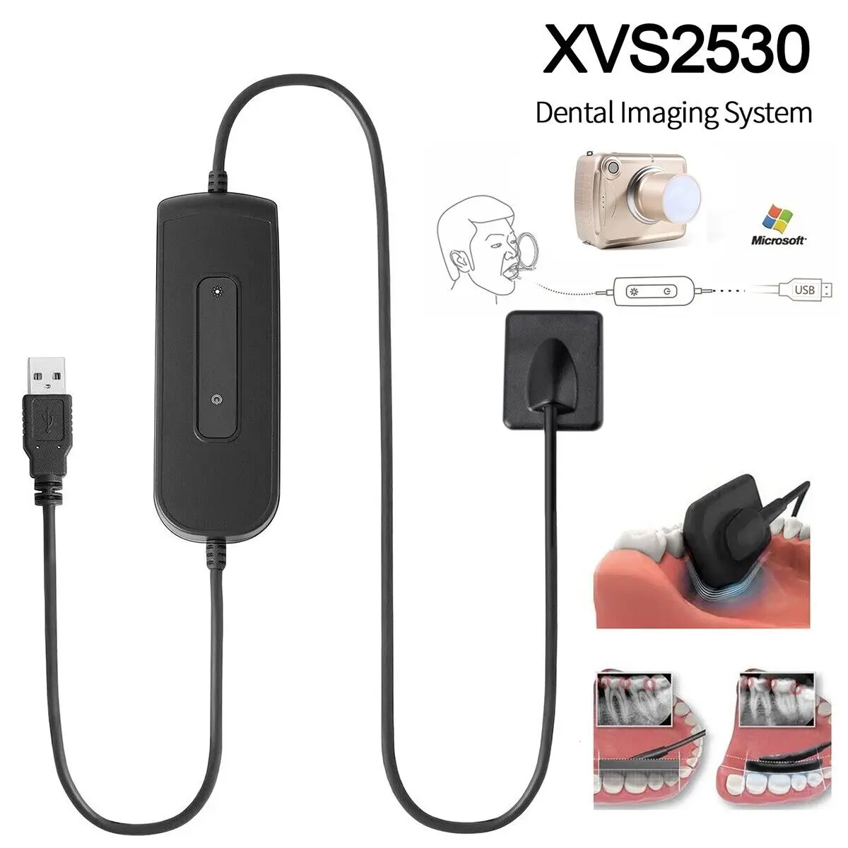 Sensor-de-rayos-X-Dental-tama-o-1-RVG-sistema-de-imagen-Digital ...