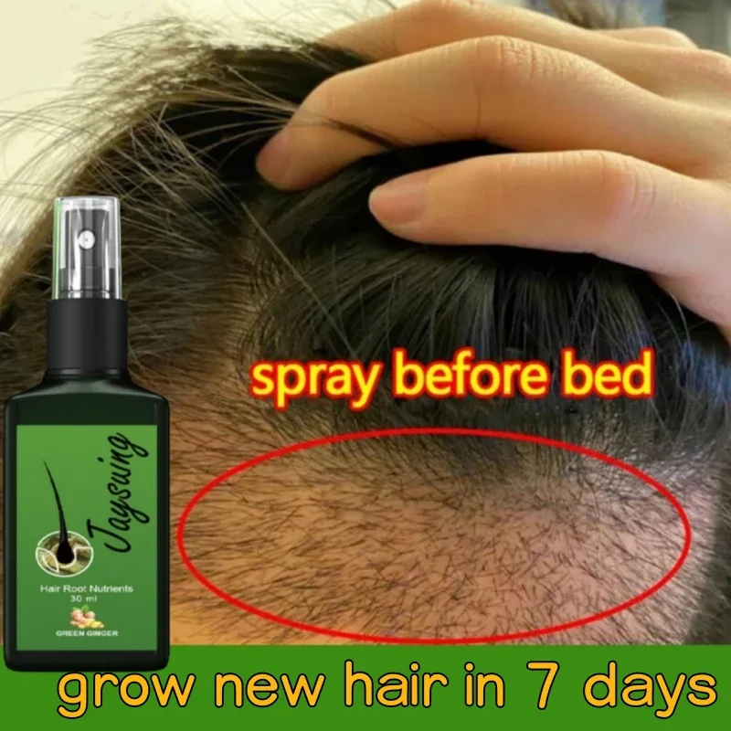 Natural Ginger Hair Growth Spray Hair Roots Fast Grow Anti Hair Loss ...