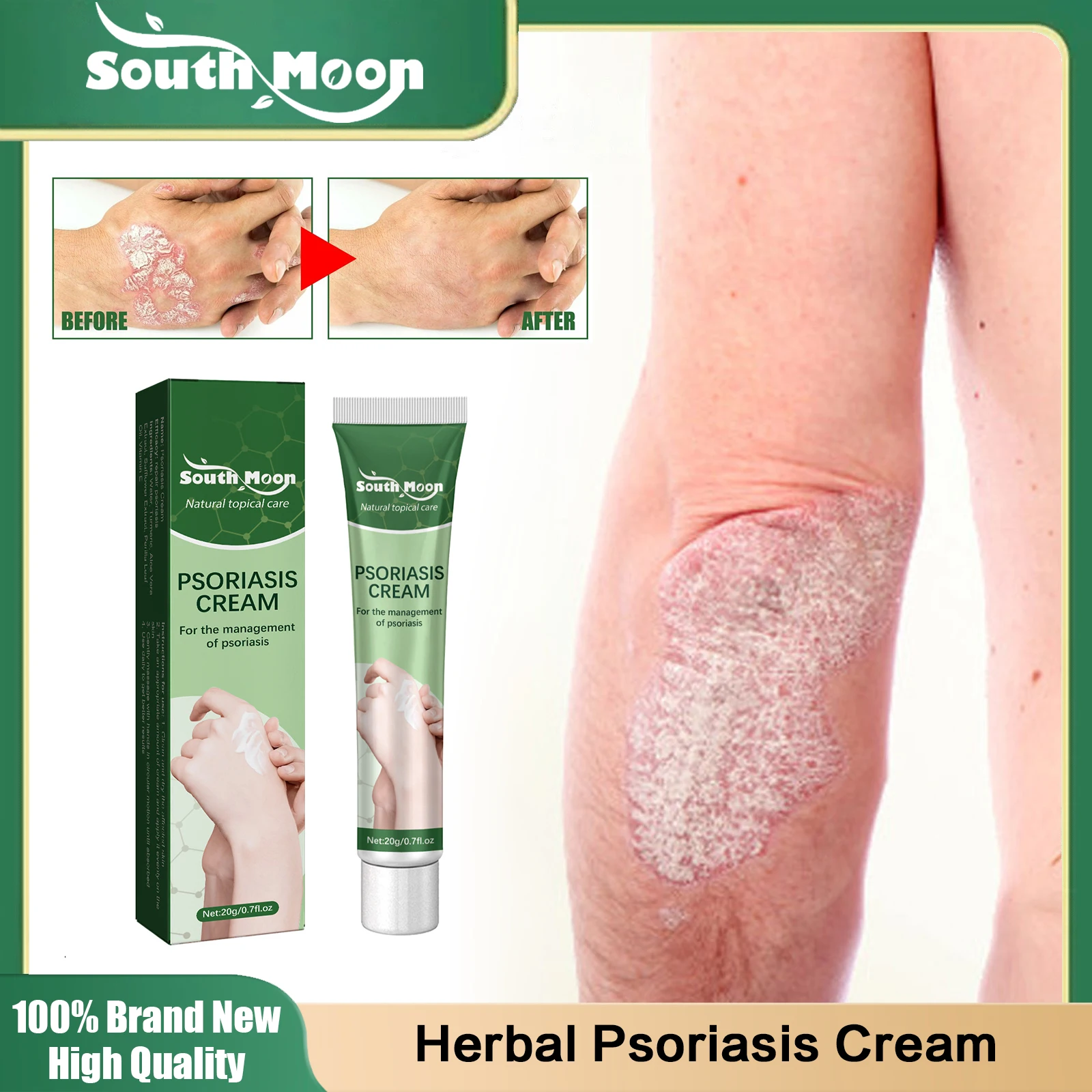 Herbal-Psoriasis-Cream-Eczema-Rash-Urticaria-Desquamation-Relief-Anti ...