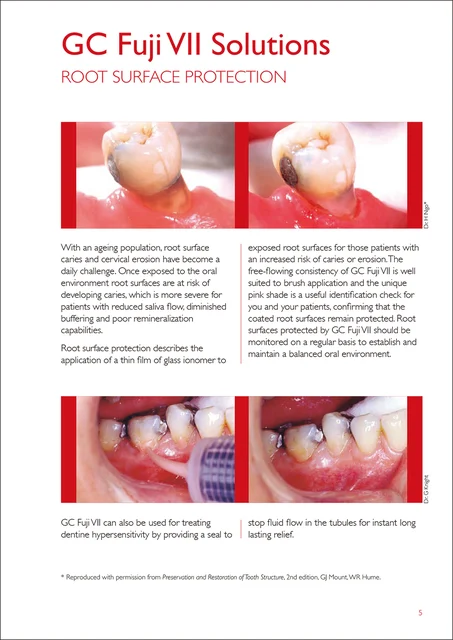 One-Stop-Shop For Dental, Ortho Lab Needs GC FUJI PLUS, , 54% OFF