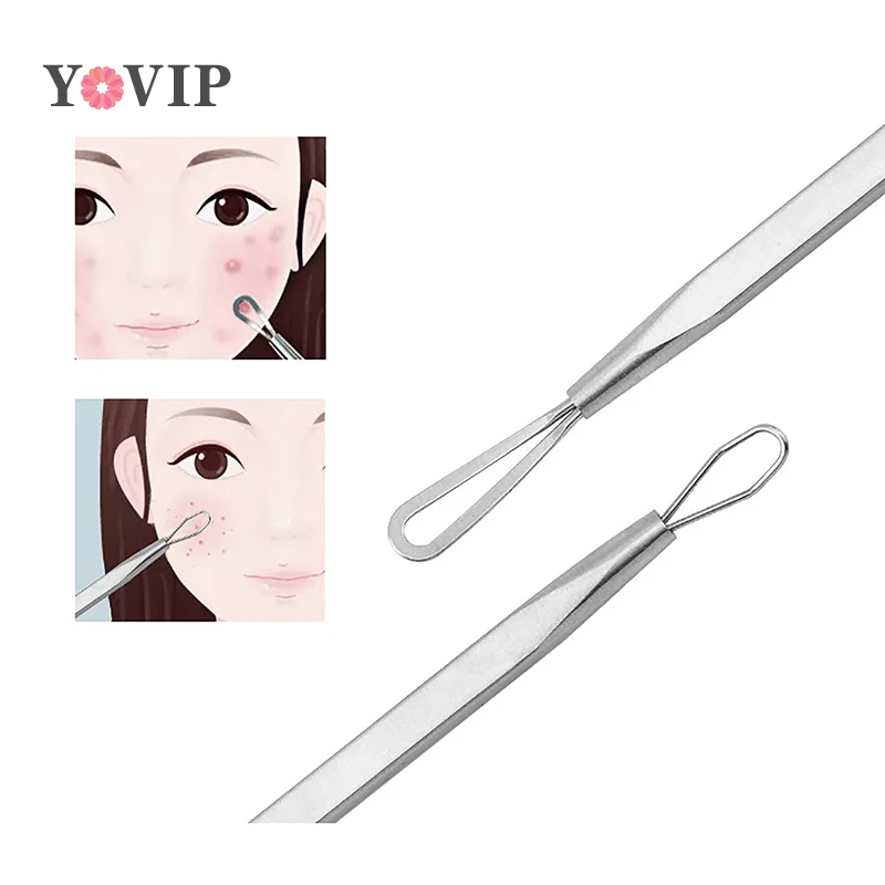 Dual Heads Acne Needle Blackhead Blemish Squeeze Pimple Extractor: My ...