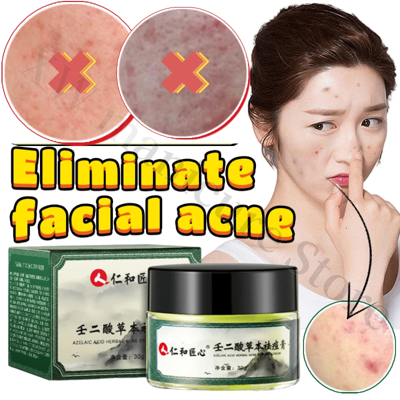 Crema reparadora a base de hierbas que alivia y repara suavemente la ...