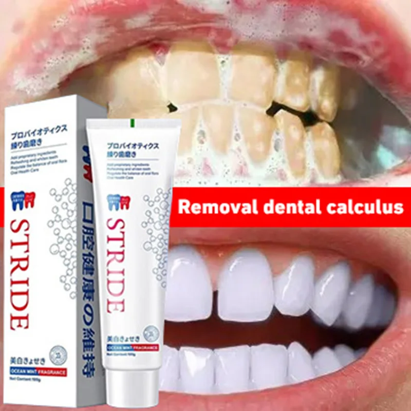Dental-Calculus-Remover-Toothpaste-Plaque-Remover-Bad-Fresh-Breath ...