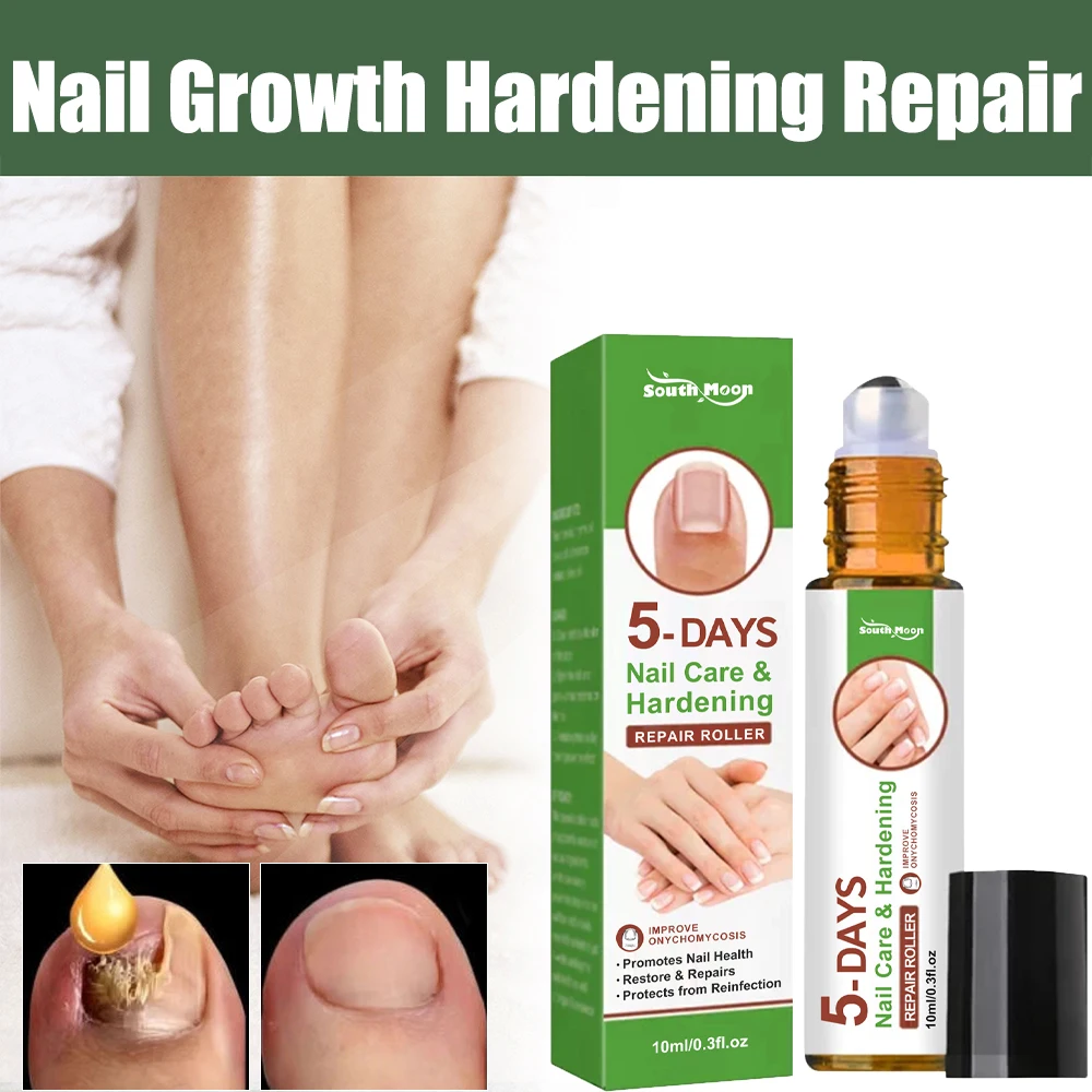 Nail-Growth-Hardening-Repair-Roller-Nail-Repair-Softening-Nails ...