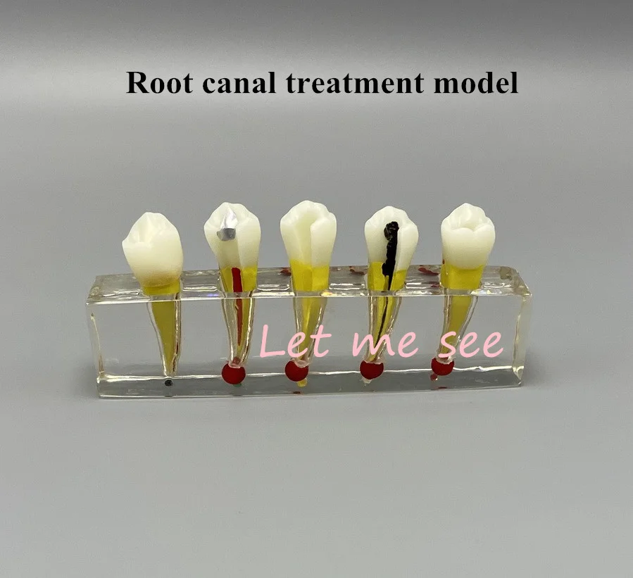 1pc-Dental-Endodontic-Teeth-Models-Root-canal-treatment-therapy-model ...