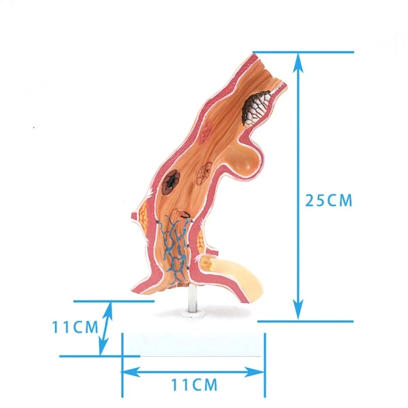 Esophagus Model Labeled
