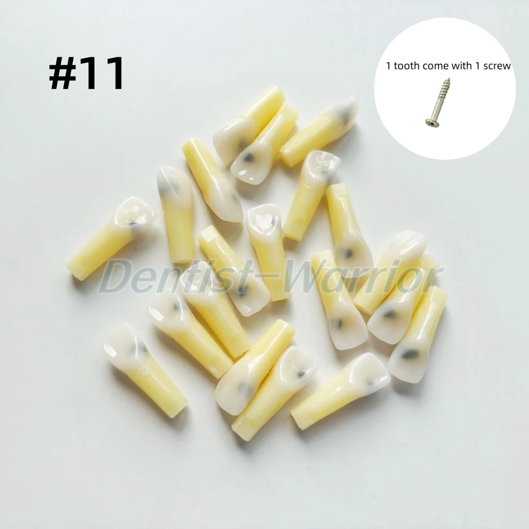 No.11 Dental Vitro Teeth Decay Caries Tooth Replica Model Dentist ...