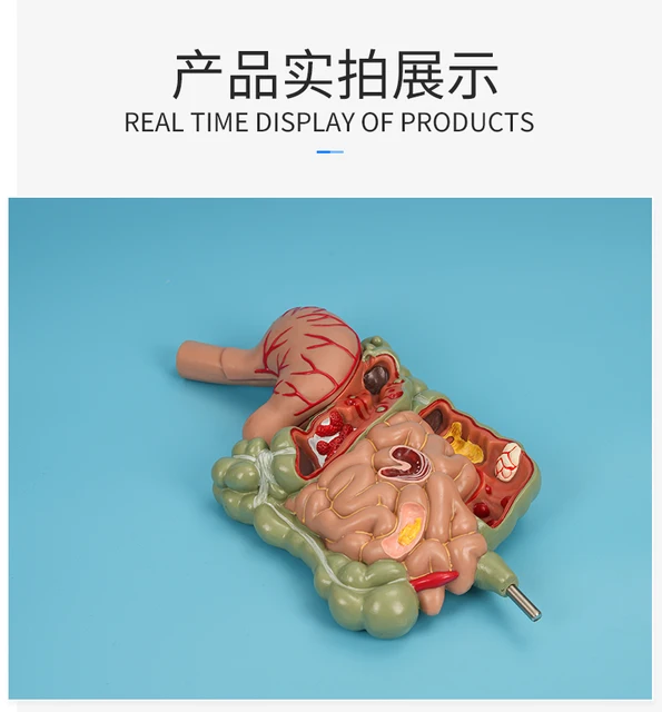 GaRcan Human Pathology Intestine Stomach Anatomical Model Large ...