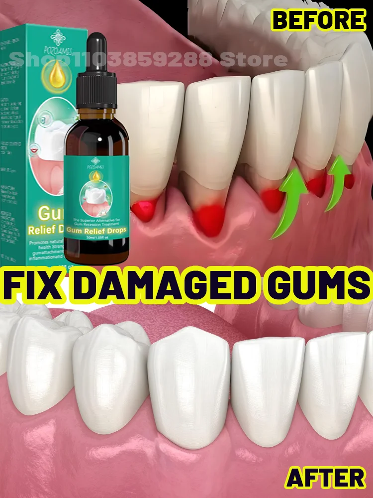 99-of-buyers-repurchase-effectively-repair-damaged-gums-relieve ...