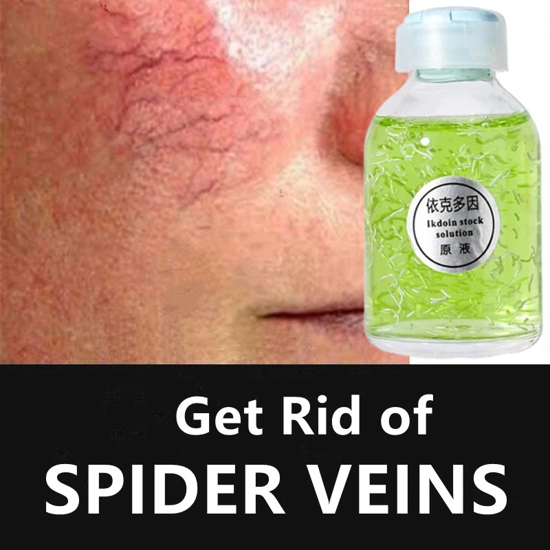 30ml Ectoin Serum Anti Redness Spider Vein Removal Advanced Treatment ...