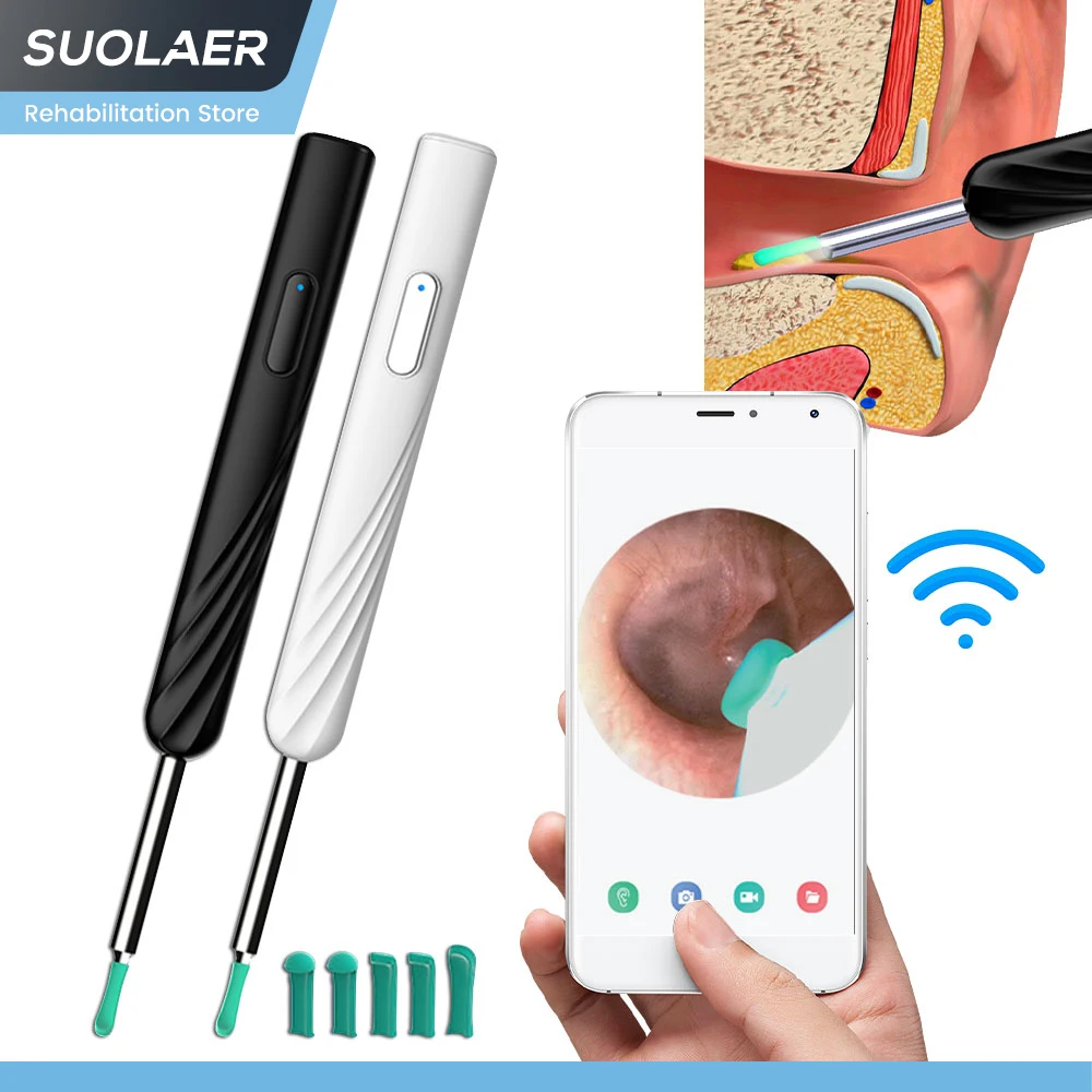 Smart-Visual-Ear-Cleaner-Wireless-Ear-Stick-Ear-Picker-3-6mm-High ...