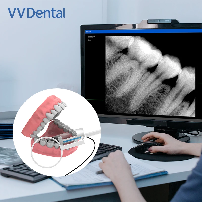 Dental-Sensor-Xray-Intraoral-Rvg-Imaging-System-Digital-Sensor-X-Ray ...