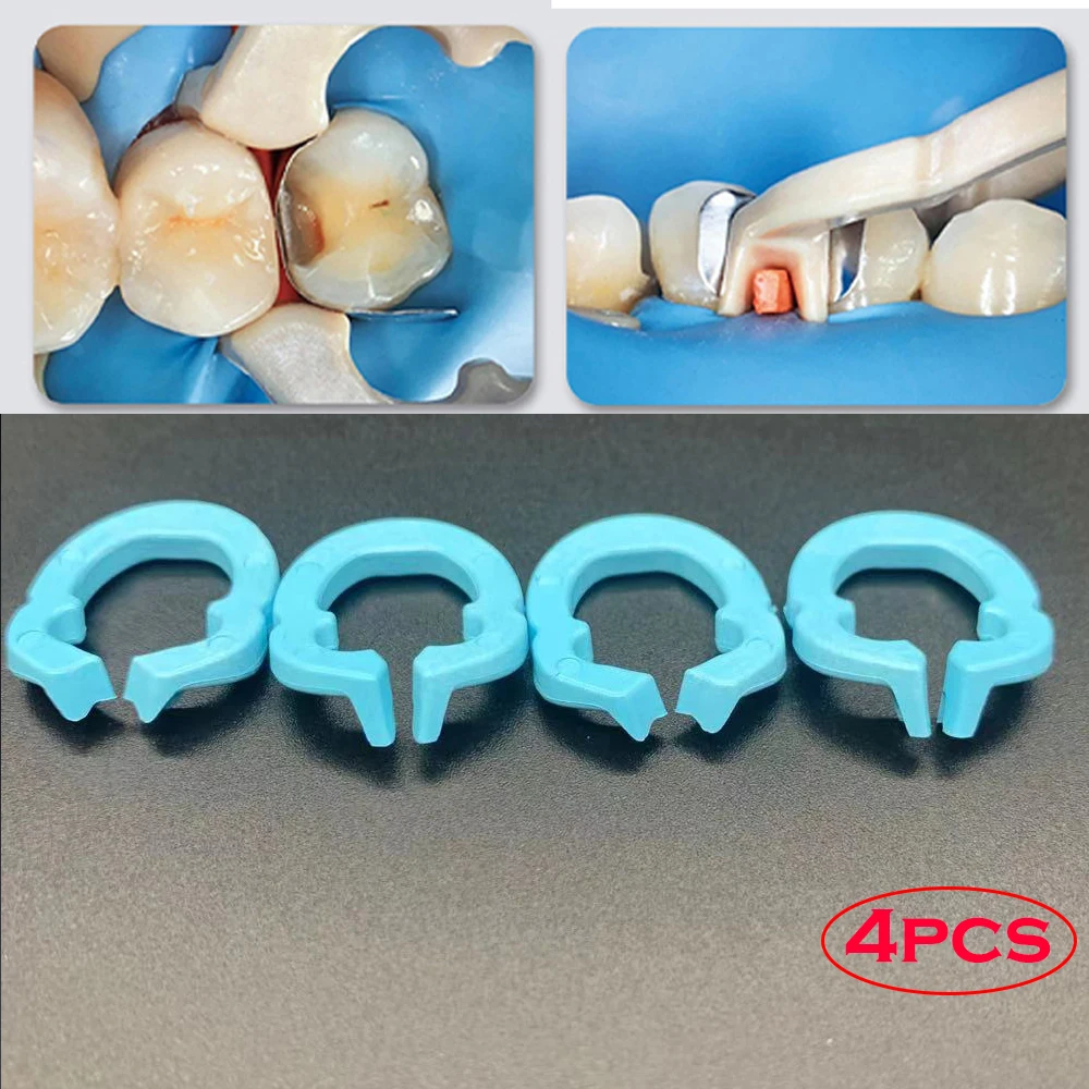 4PCS-Dental-Resin-Clamping-Ring-Separator-Ring-Sectional-Contoured ...