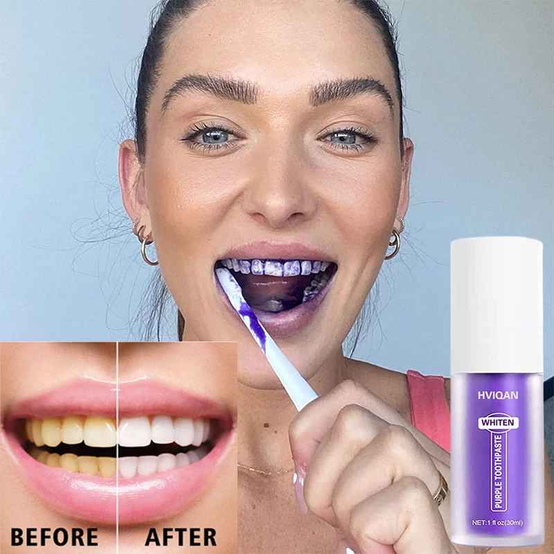 Effective-V34-Colour-Corrector-Purple-Teeth-Whitening-Toothpaste-Teeth ...
