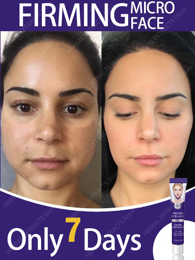 Skinny Face Cream Miracle Product V Series Skinny Face Double Chin ...