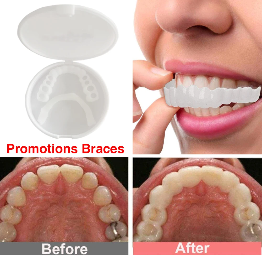 1set Perfect Fit Teeth Whitening Fake Tooth Cover Snap On Silicone ...