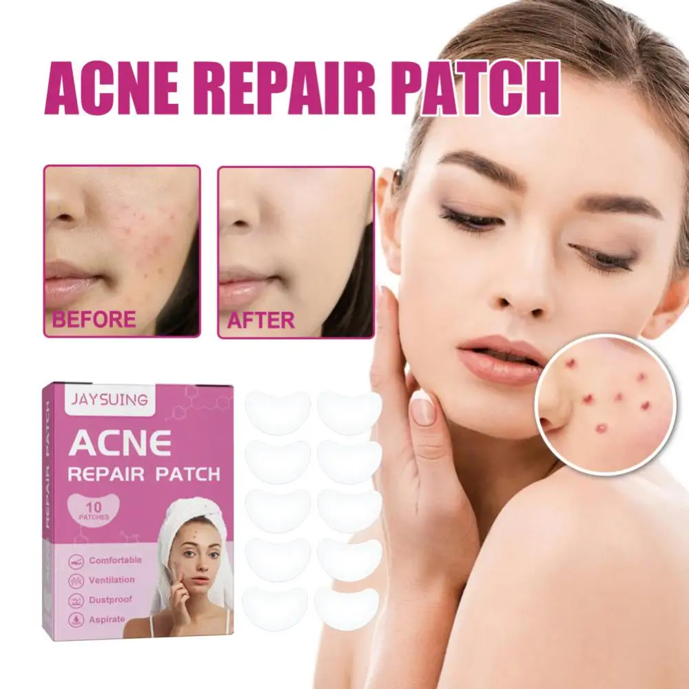 Acne On Forehead Means | ppgbbe.intranet.biologia.ufrj.br