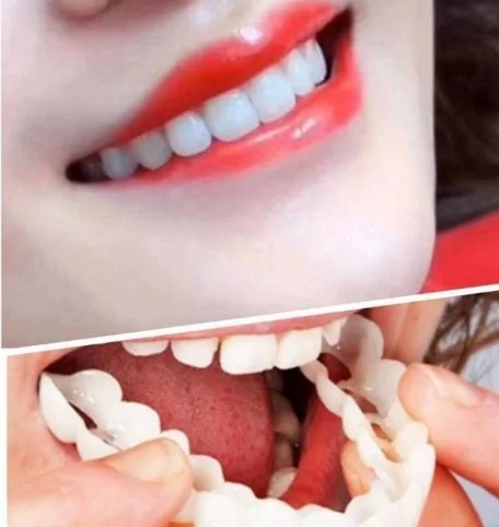 2PairDenture Teeth Instant Smiling Veneer Whitening Tooth Denture ...