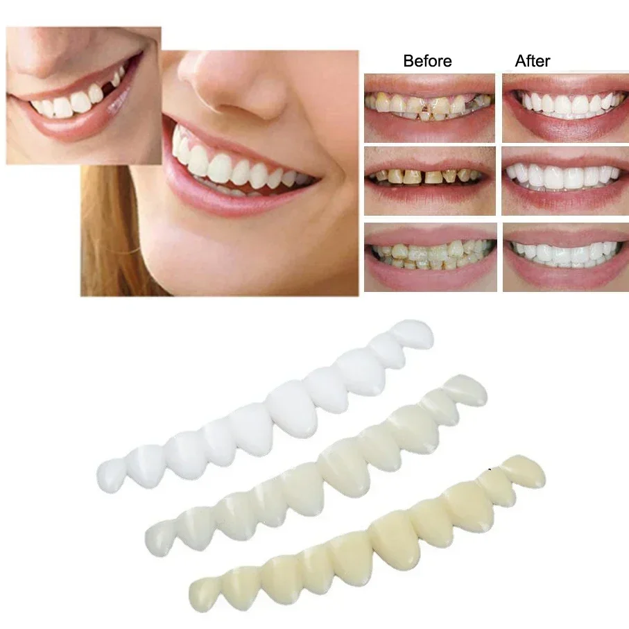 Instant-Smile-Multi-Shade-Temporary-Tooth-Replacement-Kit-TEMP-KIT-For ...