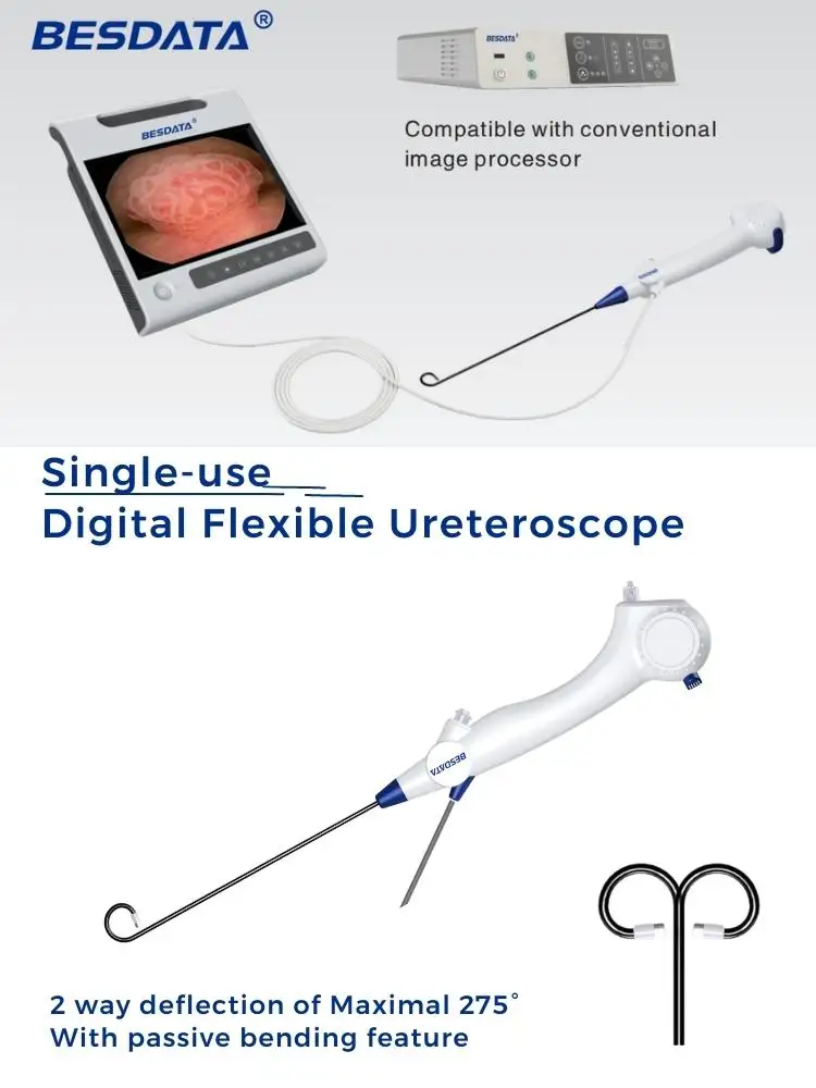 Flexible Hysteroscope