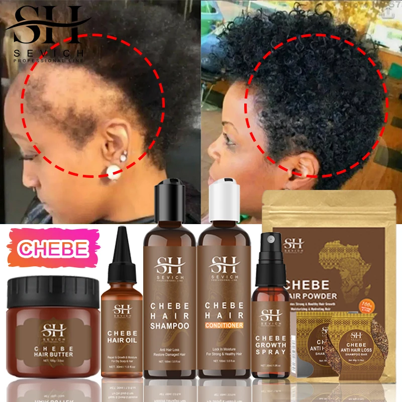7pcs-Chebe-Hair-Growth-Oil-African-Traction-Alopecia-Treatment-Chebe ...