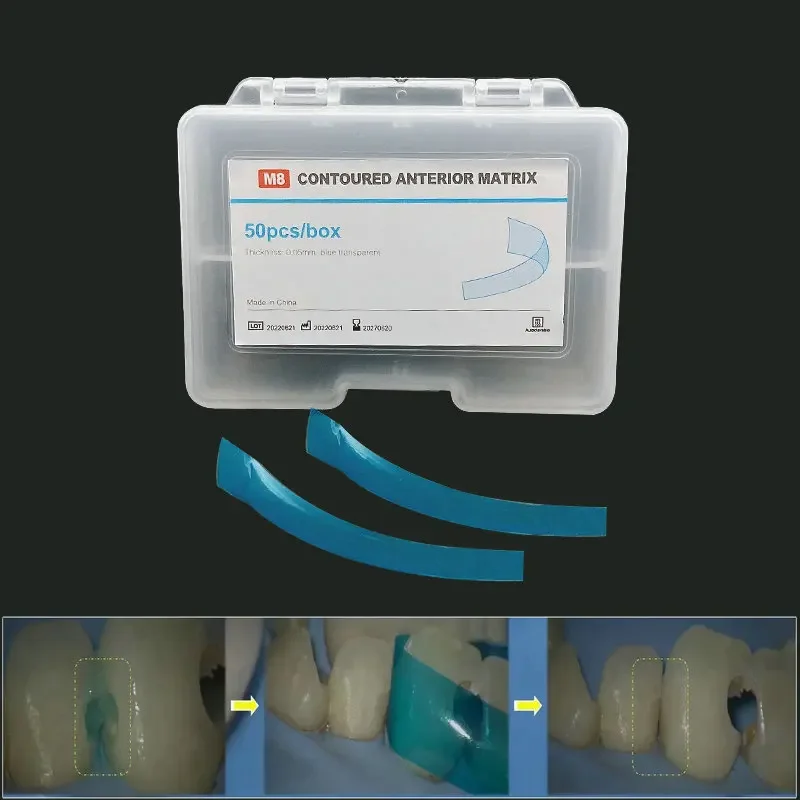 50pcs-Set-Dental-Contoured-Anterior-Matrix-Blue-Transparent-Anterior ...