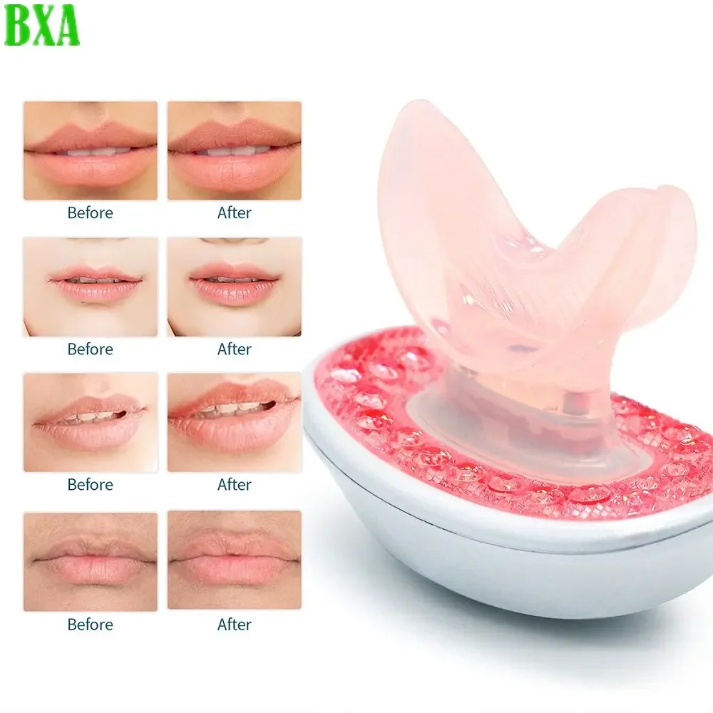 BXA-LED-Light-Therapy-Lip-Plumper-Device-Rechargeable-Lips-Enhancer-Restore-Lips-Elastic-Anti ...