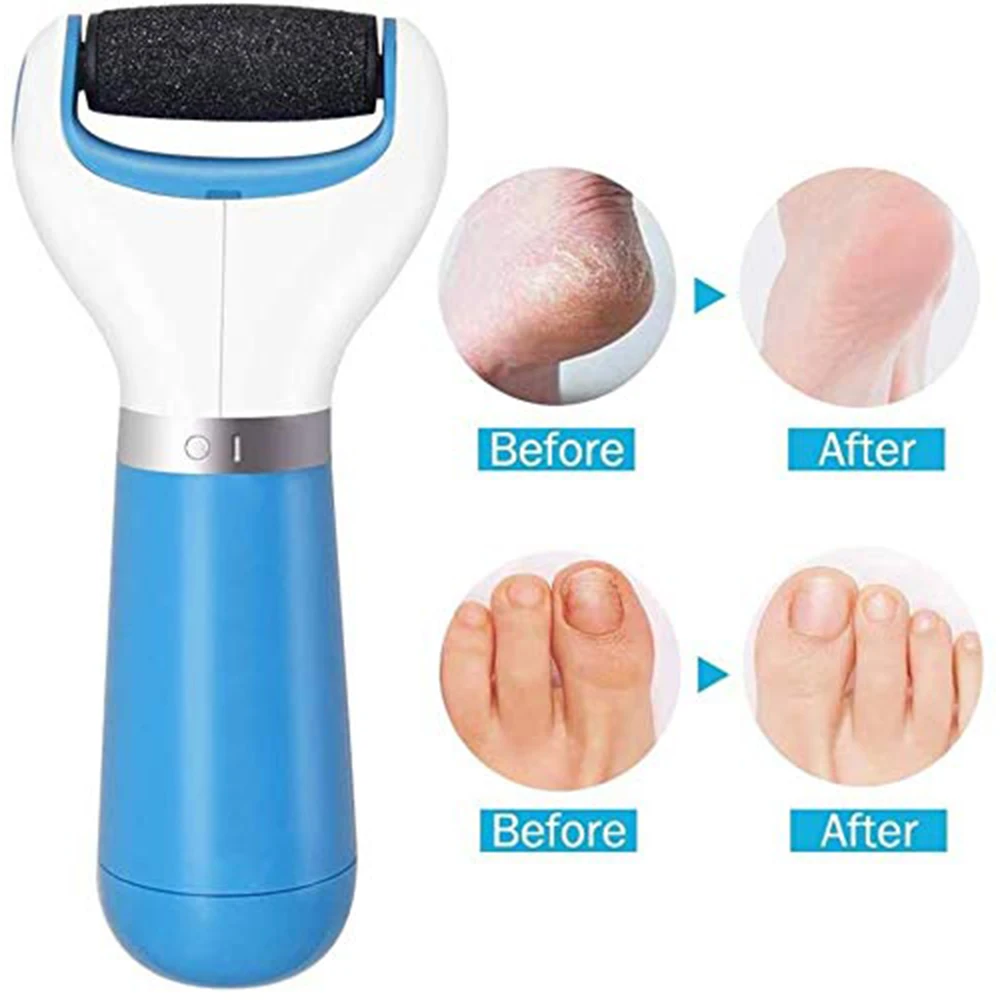 Electric-Foot-File-Scraper-Callus-Remover-Feet-Professional-Matte ...