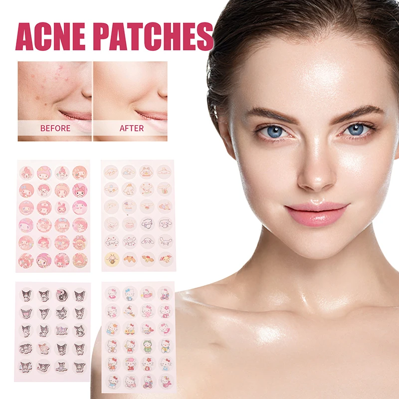 Sanrio-Hello-Kitty-Acne-Pimple-Patch-Sticker-Acne-Pimple-Remover-Tool ...