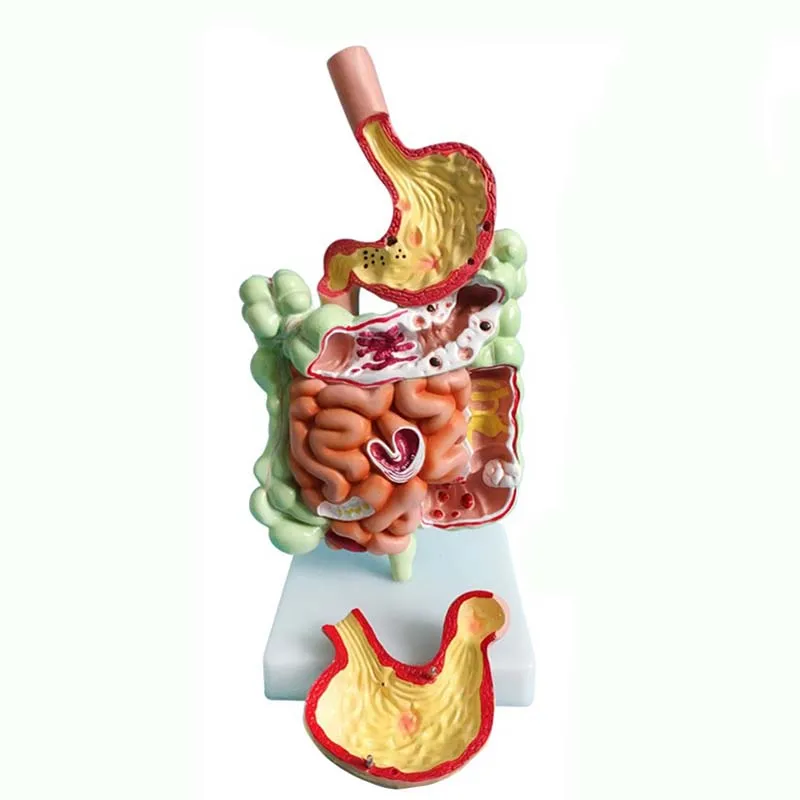Human-Digestive-System-Anatomy-Model-Medical-Teaching-Tools-Drop ...