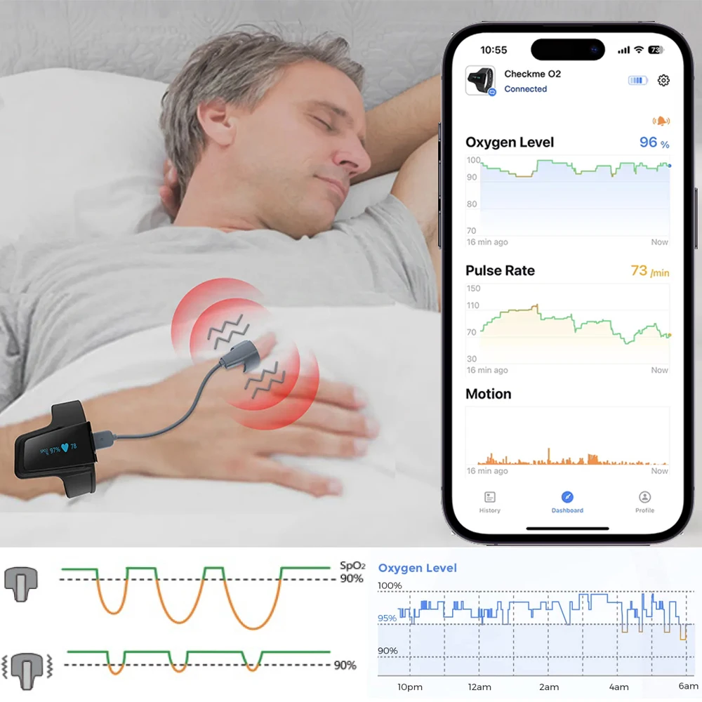 72-Hours-Smart-Reminder-Pulse-Oximeter-SpO2-Bluetooth-Blood-Oxygen ...