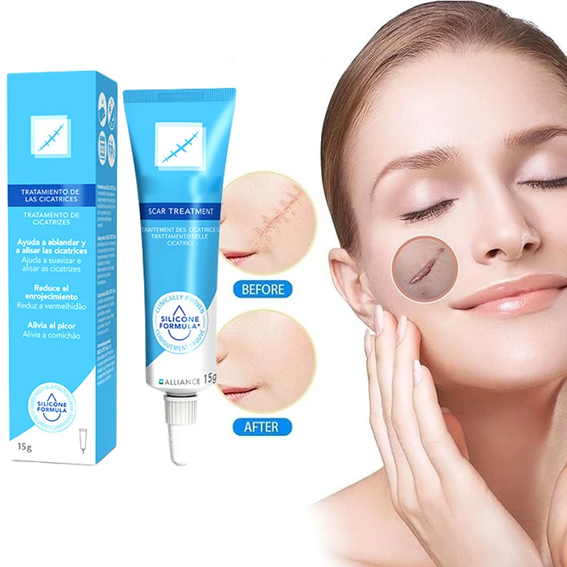 Skin Scar Removal Gel Acne Spot Removal Treatment Acne Stretch Marks ...