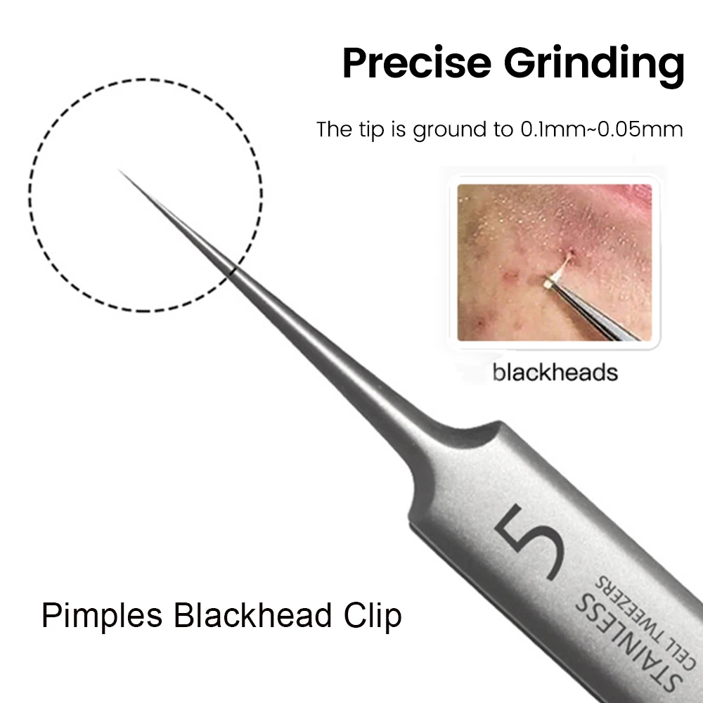 Blackhead-Remover-Clip-Pin-as-Pore-Cleaner-Acne-Needle-Tool-Limpeza ...