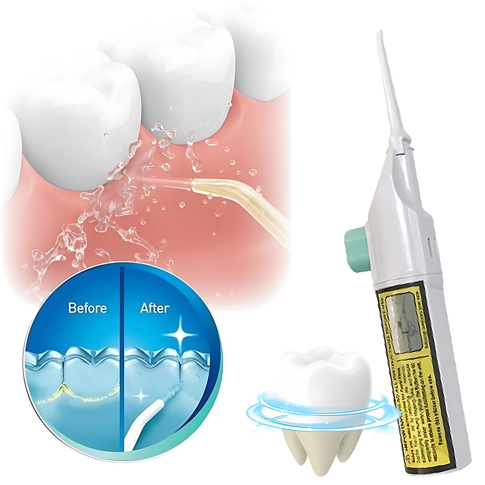 Tooth-Washers-Mouth-Flushing-Teeth-Stained-Braces-Cleaner-Hand-held ...