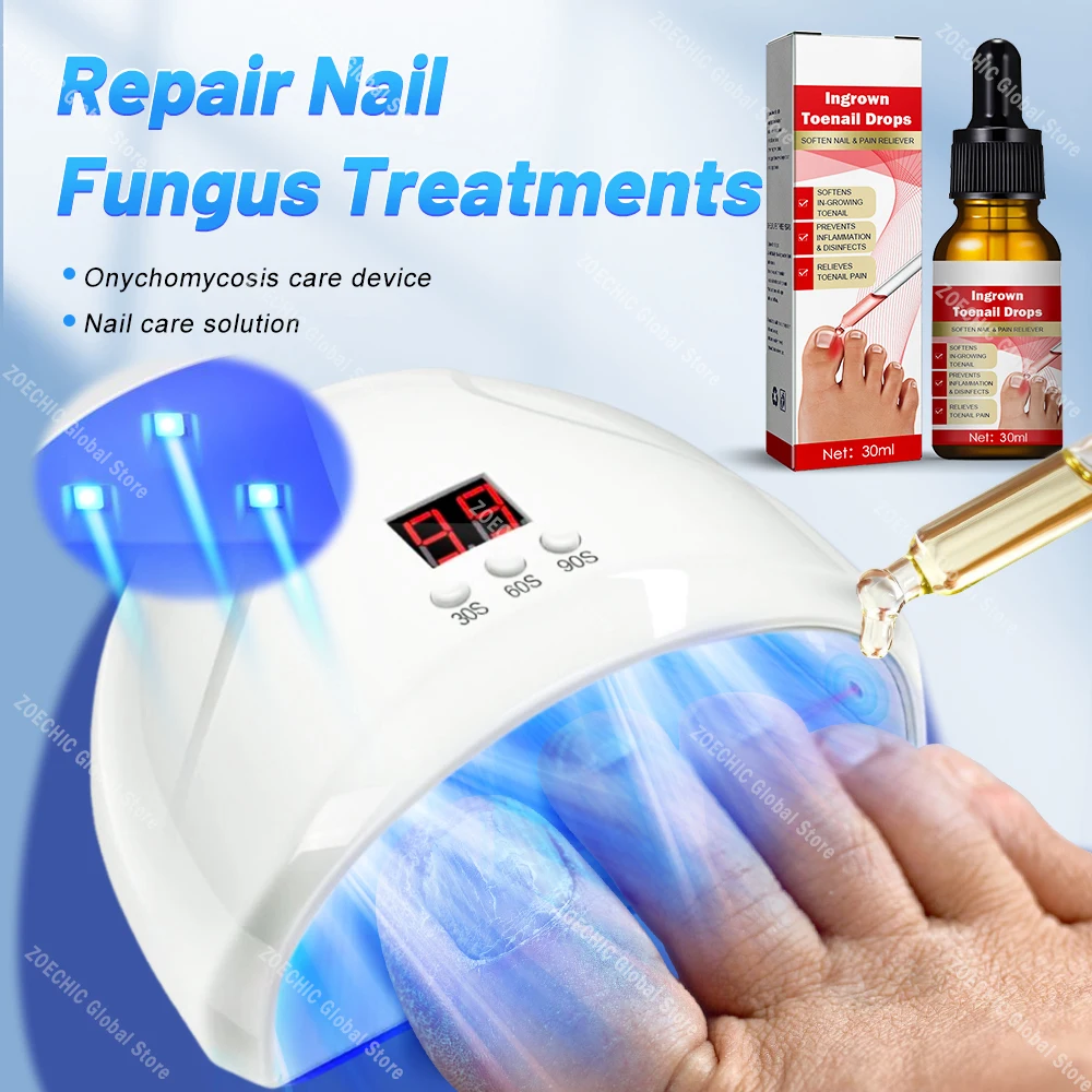 Fungal-Nail-Laser-Device-Repair-Fast-Nails-Fungus-Onychomycosis-Anti ...