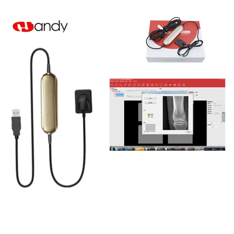 Sensor-de-rayos-X-Dental-Intraoral-HDR500B-Digital-RVG-USB-buena ...