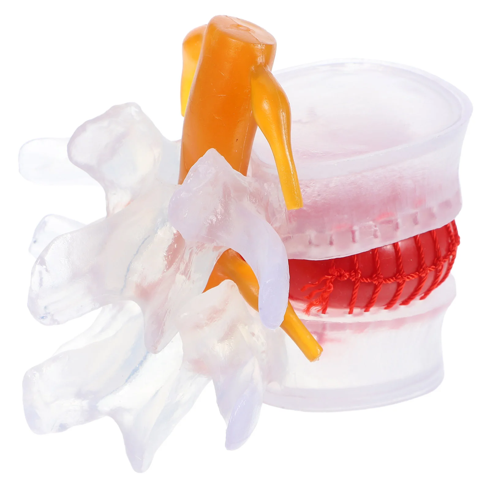 renciler-i-in-insan-lomber-disk-herniasyon-modeli-g-steri-insan-lomber ...