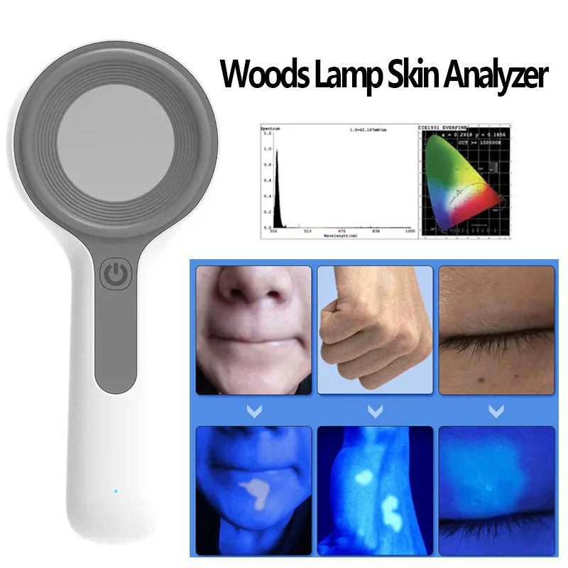 Glenn-Wood-Skin-Lamp-Analysis-Machine-for-Skin-Analyzer-Examination ...